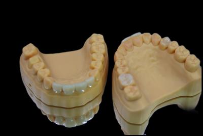 China Stain Resistance Dental Veneer Minimally Invasive Porcelain Veneer Teeth for sale