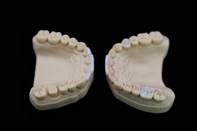 China Anatomical Dental Veneers Chinese Dental Laboratory Porcelain Veneers Stain Resistance for sale