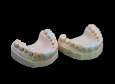 China Durable Flexible Denture Dental Veneers Composite Veneer Stain Resistance for sale