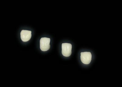 China Permanent Teeth Ceramic Veneer Translucency China Outsourcing Dental Lab for sale