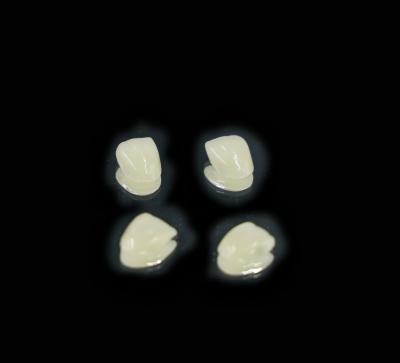 China Crowns Dental Veneer Minimally Invasive Porcelain Veneer Teeth for sale