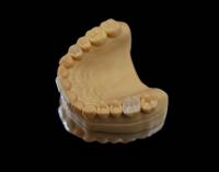 Quality Lithium Disilicate Dental Emax Inlay China Dental Lab CE Marked for sale