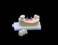 Quality Medical Grade Titanium Zirconia Dental Implant Abutments With Universal for sale