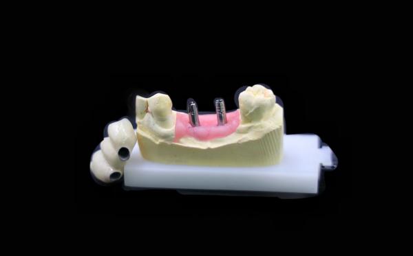 Quality Precision Digital Dental Design Services Compatibility Zirconia Implant for sale