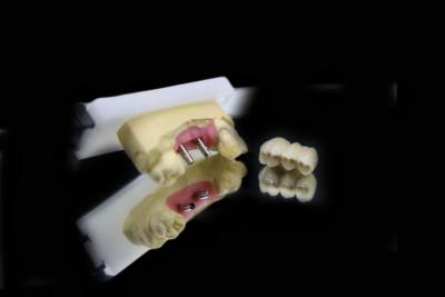 China Titanium China Dental Outsourcing Medical Grade Zirconia Dental Implant Abutments for sale