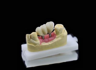 China Zirconia China Outsourcing Dental Lab Medical Grade Titanium Dental Implant for sale