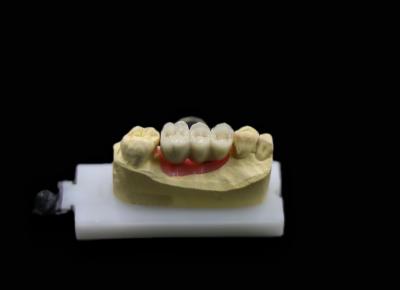 China CE Chinese Dental Laboratory Titanium / Zirconia Dental Implant Abutments for sale