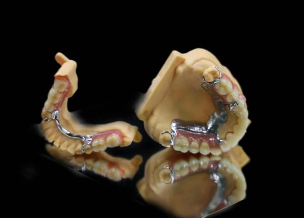 Quality Biocompatible CCP Dental Cobalt Chromium Alloy Metal Framework for sale