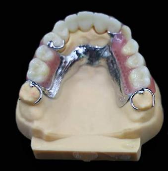 China Dental Laboratory China CCP Cast Metal Framework Metallic Silver for sale