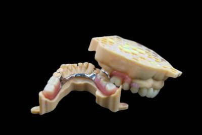 China Hypoallergenic Dental Framework Polished China Dental Lab Outsourcing for sale