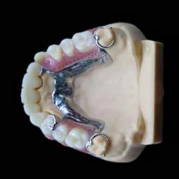 Quality Hypoallergenic Dental Framework Polished China Dental Lab Outsourcing for sale