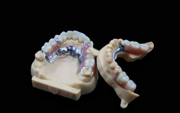 Quality Precision Digital CCP Dental Framework Cobalt Chromium Alloy Metal Framework for sale