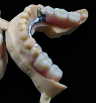 Quality Precision Digital CCP Dental Framework Cobalt Chromium Alloy Metal Framework for sale