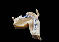 China 3D Printed Dental Metal Framework for Removable Partial Dentures CoCr Alloy 25-50µm for sale
