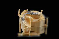 China 3D Printed Dental Metal Framework for Removable Partial Dentures CoCr Alloy 25-50µm for sale