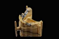 Quality 3Shape Metal Framework Dental Lab China CAD Exocad Partial Framework for sale