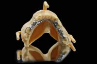 China 3D Printed Cobalt Chromium Partial Denture Framework 25-50 Micron Layer Dental Lab for sale