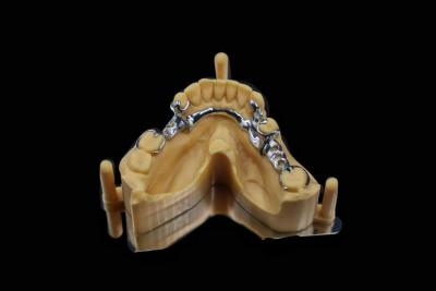 China 3D Printed Exocad Framework Cobalt Chromium Alloy CCP Framework for sale