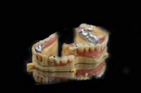 China 3D Printed Cobalt Chromium Alloy Framework for Removable Partial Dentures 800 MPa for sale