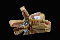 Quality RPDs Exocad Partial Framework Digital Lab CCP Partial Denture Framework Design for sale