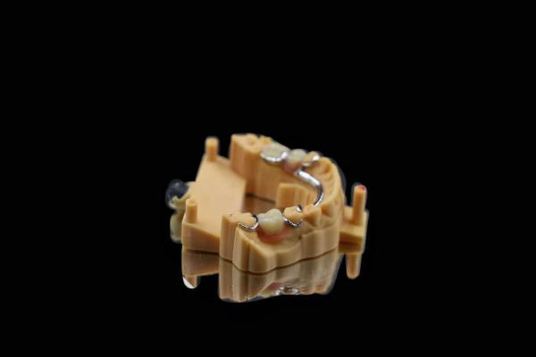 Quality RPDs Exocad Partial Framework Digital Lab CCP Partial Denture Framework Design for sale