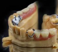 Quality Cobalt Chromium Alloy CCP Framework Dental Lab Polished Surface for sale