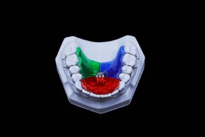 China SS Removable Palate Expander Medical Grade Dental Expander Customizable for sale