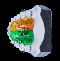 China Pre-Prosthetic Maxillary Expander Hyrax Tooth Borne 0.20-0.25 mm Expansion for sale