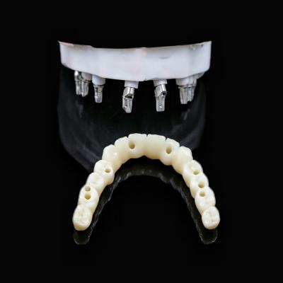 China Durable Biocompatible Artificial Tooth Root Implant Suitable for Dental Restoration Procedures and Long Term Stability for sale