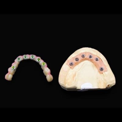 China Precision Engineered Artificial Tooth Root Offering Support and Enhanced Healing for Dental Reconstruction Applications for sale
