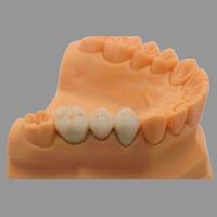Quality Dental PFM Crown And Bridge Customizable With CoCr Ceramic Materials for sale