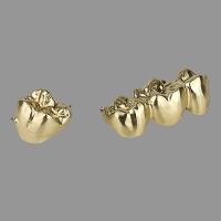 Quality Dental Clinics Full Gold Crown Smooth Polished Wear Resistant for sale