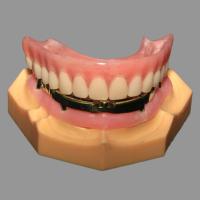 Quality Full Acrylic Denture All On X Dental Implants AOX Class 4 With Locator for sale