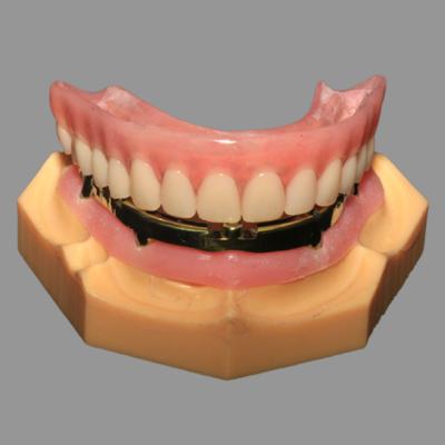 China Full Acrylic Denture All On X Dental Implants AOX Class 4 With Locator Attachment for sale