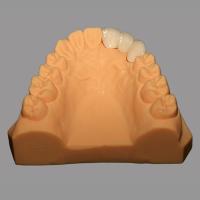 Quality Biocompatible Full Ceramic PFZ Bridge With CAD / CAM System for sale