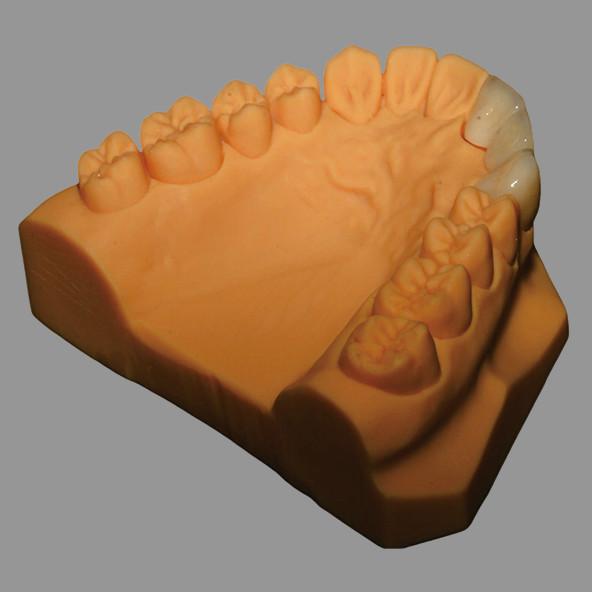 Quality Biocompatible Full Ceramic PFZ Bridge With CAD / CAM System for sale