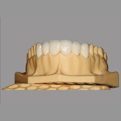 China Aesthetic Porcelain Fused To Zirconia Bridge Hypoallergenic for sale