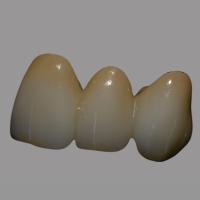 Quality Natural Full Contour Zirconia Bridge Single Unit / Multiunit Wear Resistant for sale