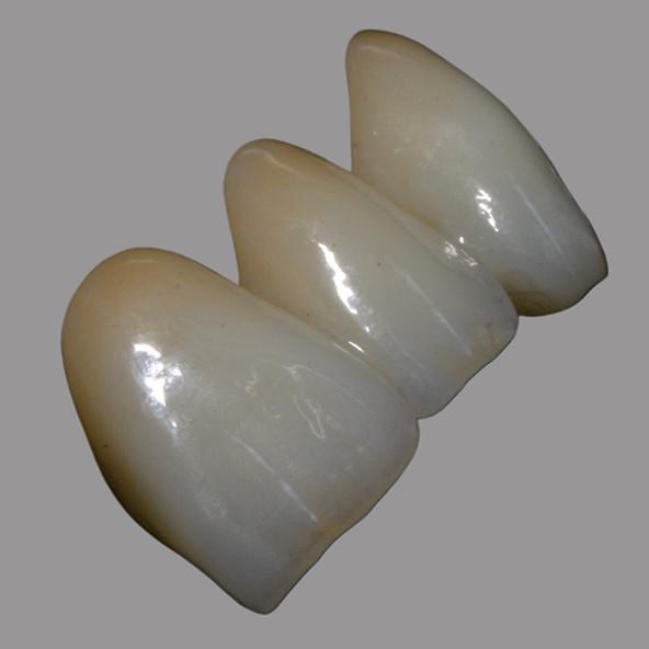Quality Natural Full Contour Zirconia Bridge Single Unit / Multiunit Wear Resistant for sale