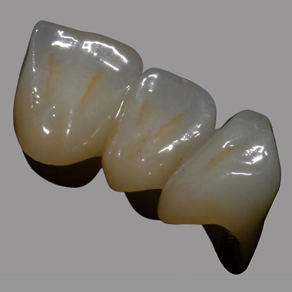 Quality Natural Full Contour Zirconia Bridge Single Unit / Multiunit Wear Resistant for sale