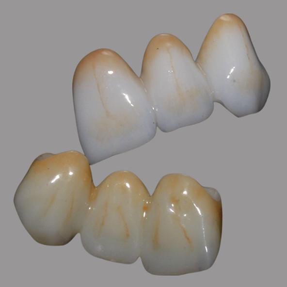 Quality Natural Full Contour Zirconia Bridge Single Unit / Multiunit Wear Resistant for sale