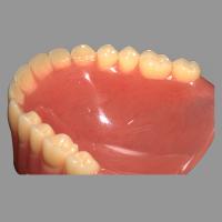 China Digital Dental Design Services | Casting Full Acrylic Denture Heat Curing Full Arch Shaped for sale