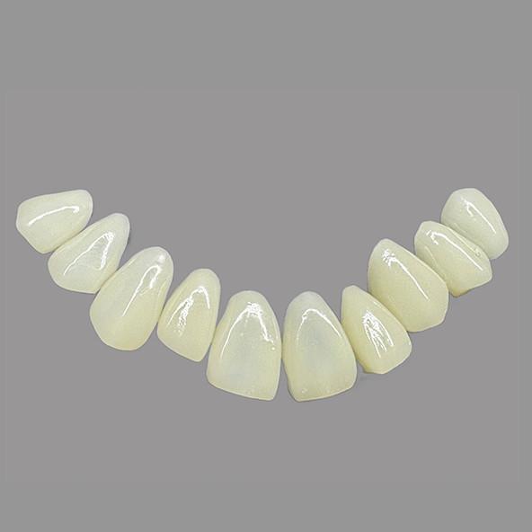 Quality High Translucency IPS E Max Veneers Stains Resistant Biocompatible for sale