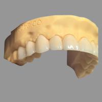 Quality Smooth Pressed IPS EMax Crowns Staining Resistant Customizable for sale