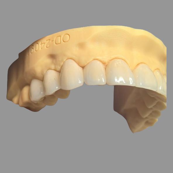 Quality Smooth Pressed IPS EMax Crowns Staining Resistant Customizable for sale