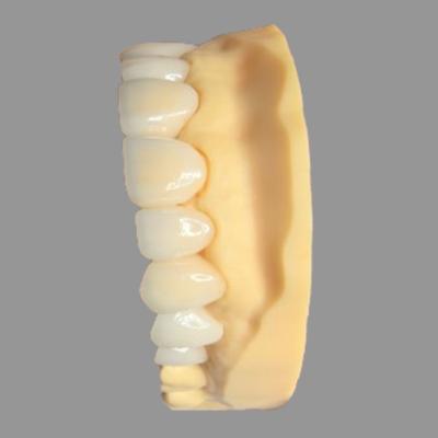 China Smooth Pressed IPS EMax Crowns Staining Resistant Customizable for sale