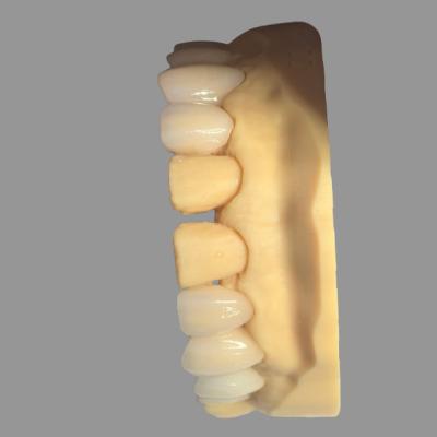 China Smooth Pressed IPS EMax Crowns Staining Resistant Customizable for sale