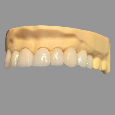 China Smooth Pressed IPS EMax Crowns Staining Resistant Customizable for sale