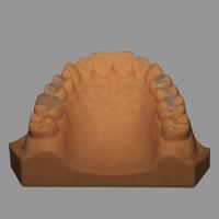 Quality Full Ceramic Dental Emax Inlay Onlay Crown Pressed / Milled for sale