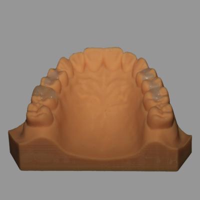 China Full Ceramic Dental Emax Inlay Onlay Crown Pressed / Milled for sale